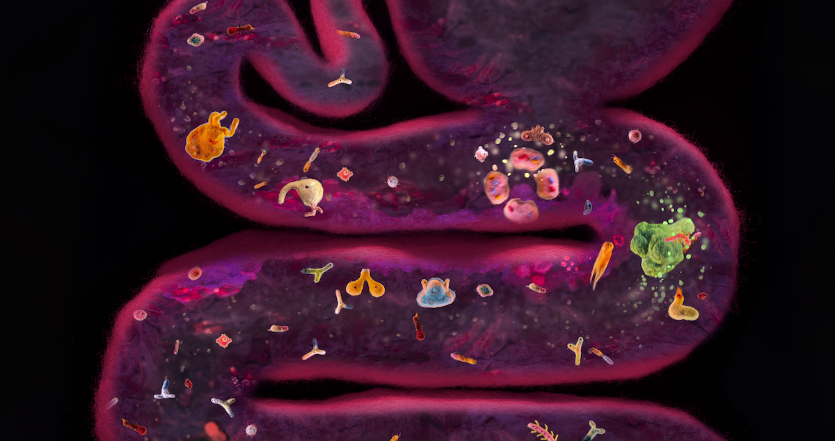 Hack Your Health: The Secrets of Your Gut Documentary Explores How to ... Hack Your Health: The Secrets of Your Gut Documentary Explores How to ...